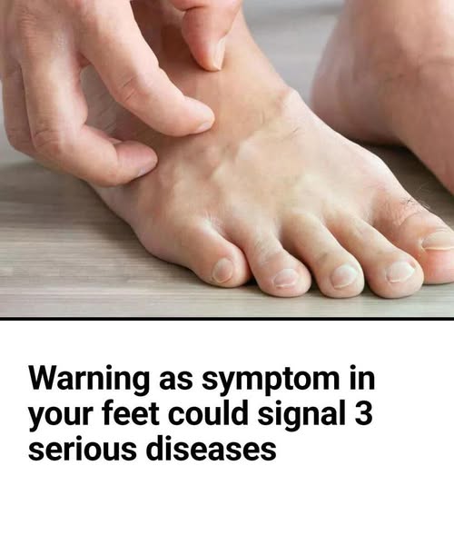 Wa:rning as symptom in your feet could signal three serious diseases ...